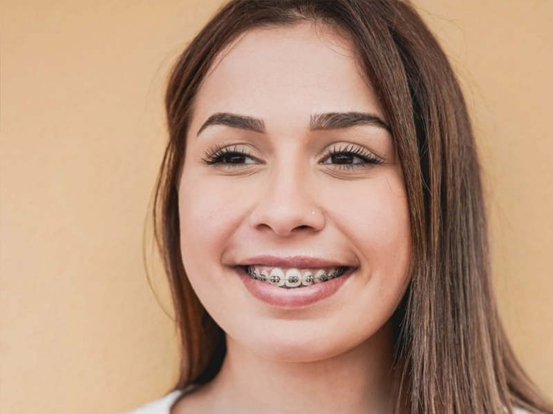Traditional Braces in The Woodlands, TX | Dentistry and Orthodontics